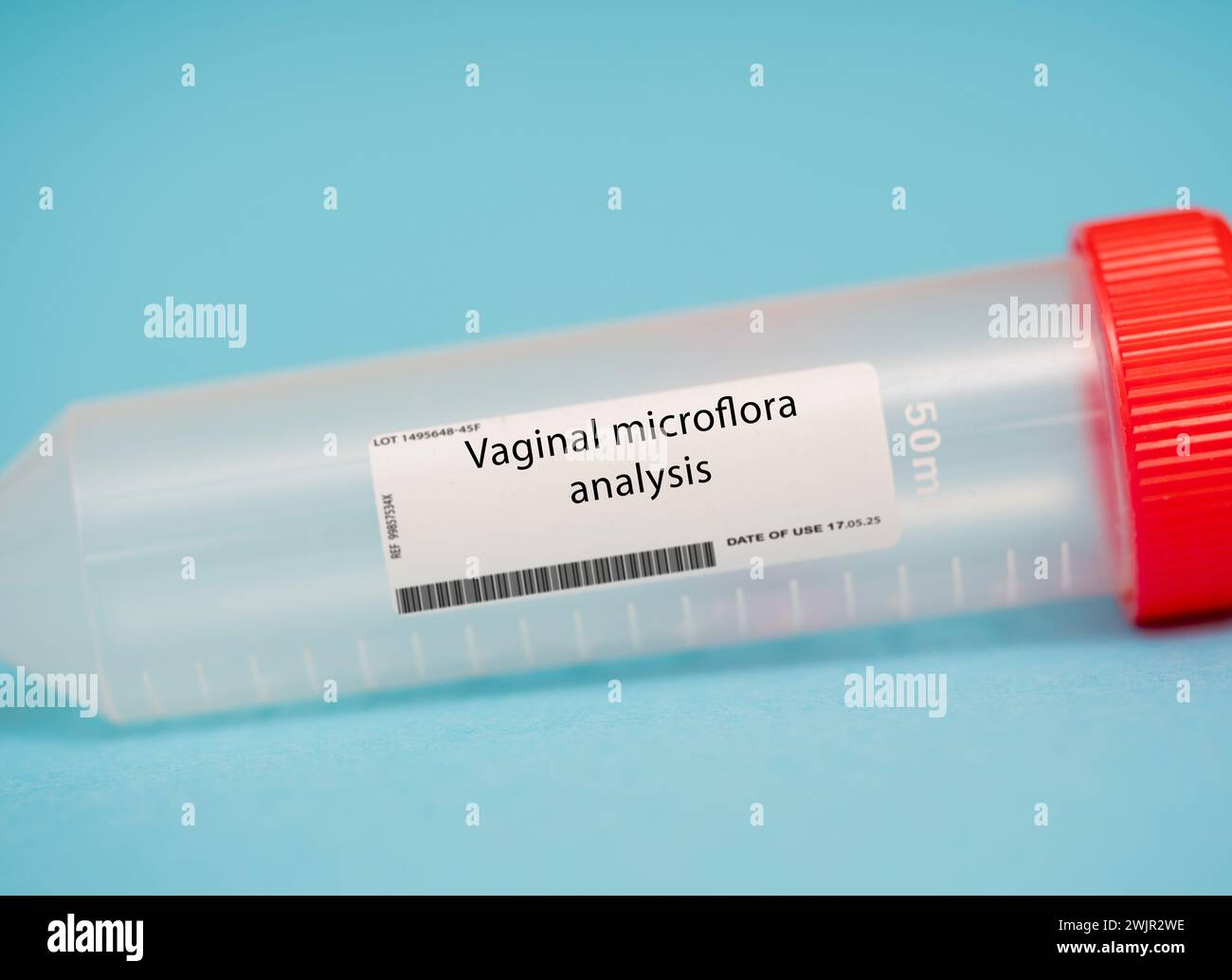 Vaginal microflora analysis. This test is used to analyse the types and ...