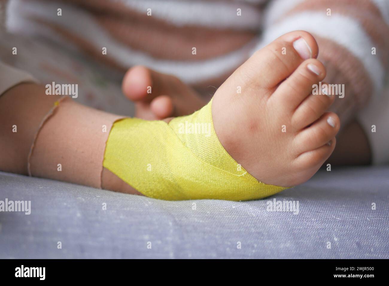 Elastic therapeutic yellow tape applied to child leg. Kinesio Taping ...