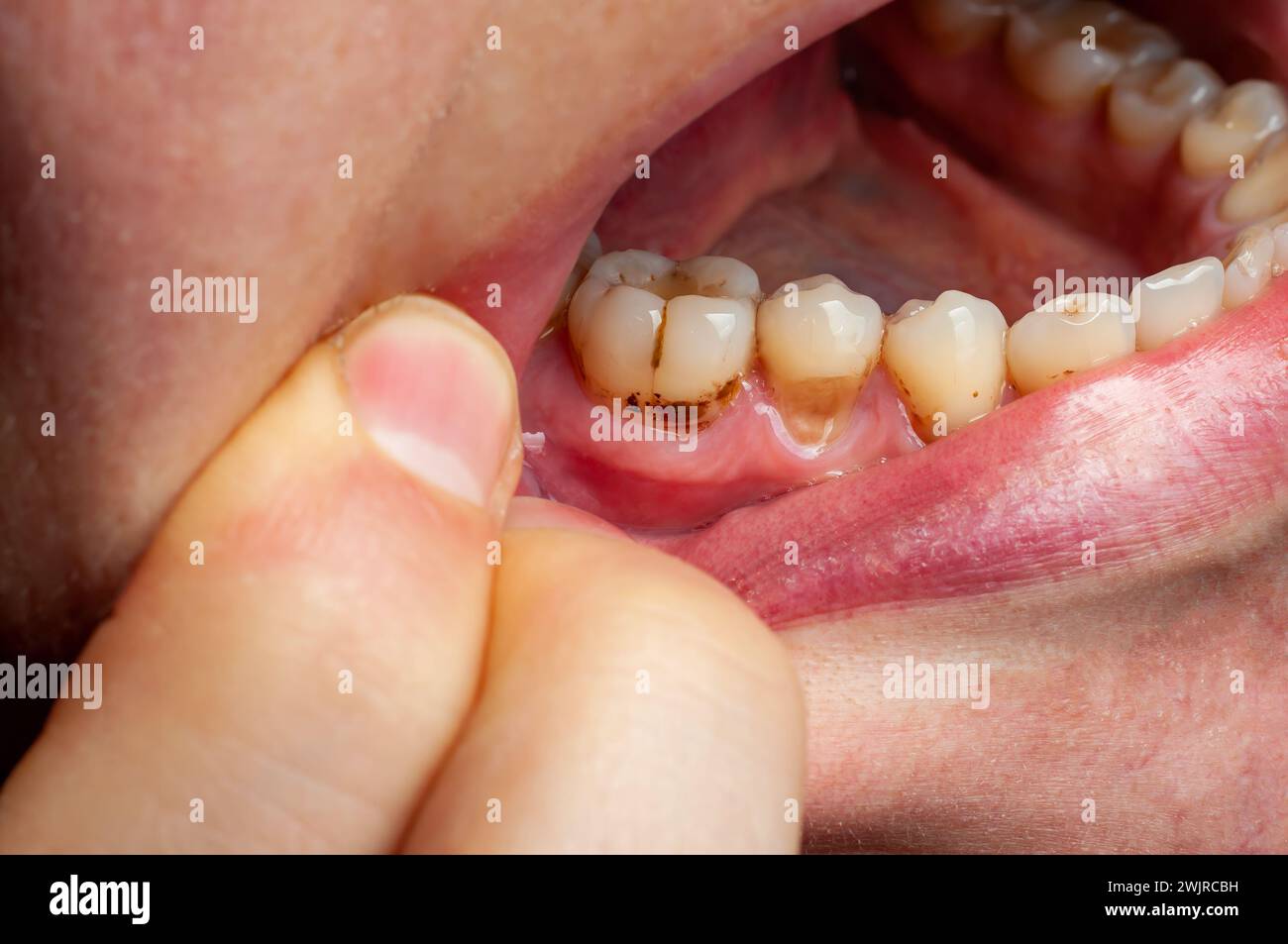 A detailed view of someone brushing their teeth, showing the action of ...