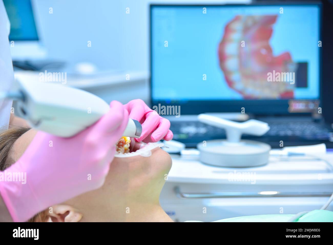 Dentist hands scaning patient's teeth with dental 3d scanner and laptop ...