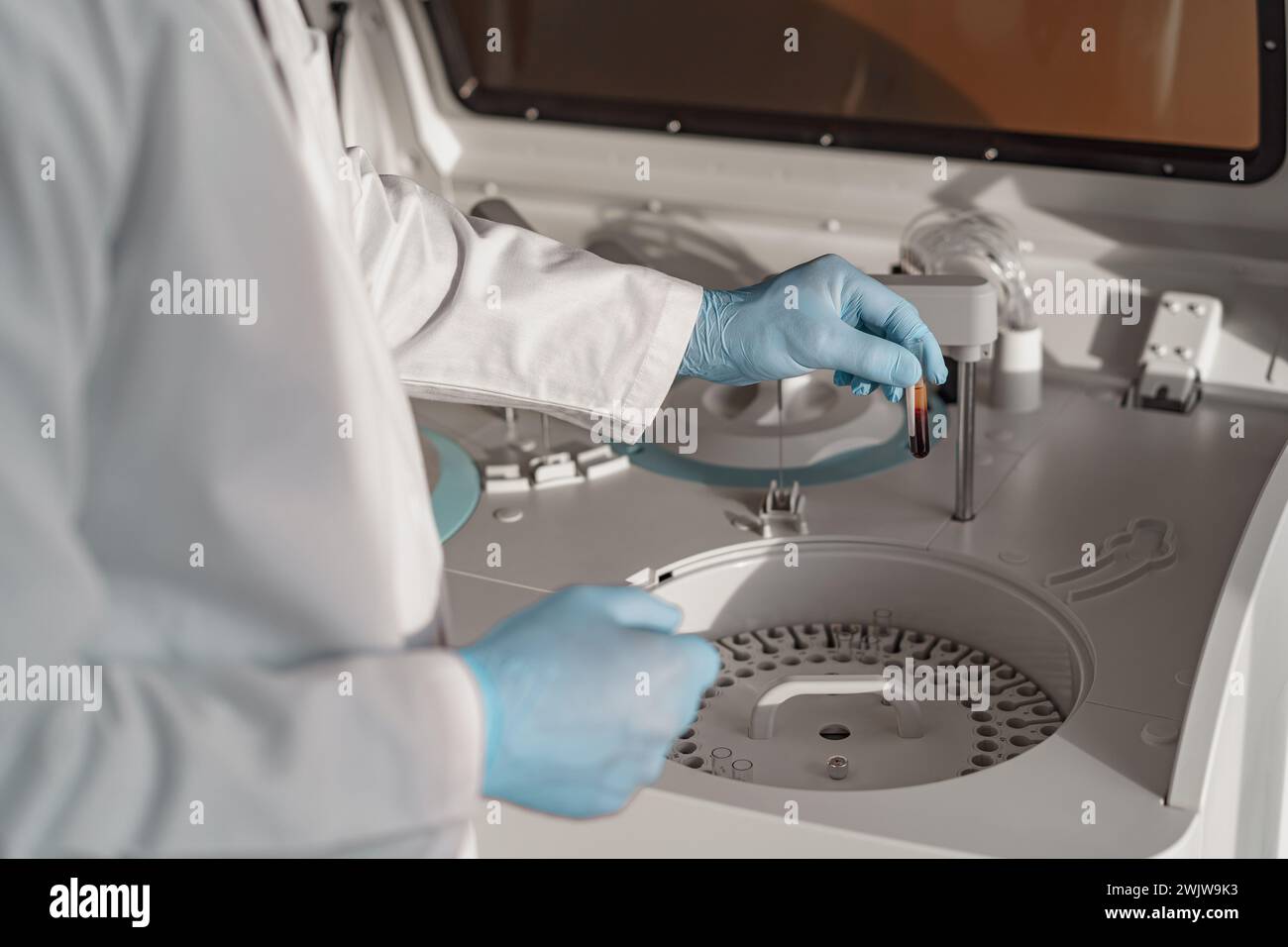 Close up of researcher hand in sterile glove putting test tube into ...
