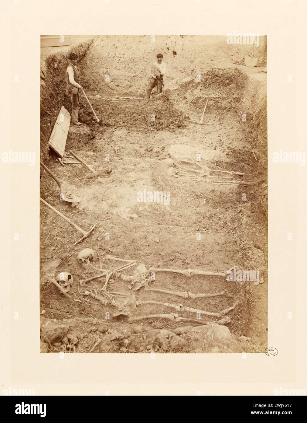 Couple of skeletons updated during excavations. Paris. Anonymous ...