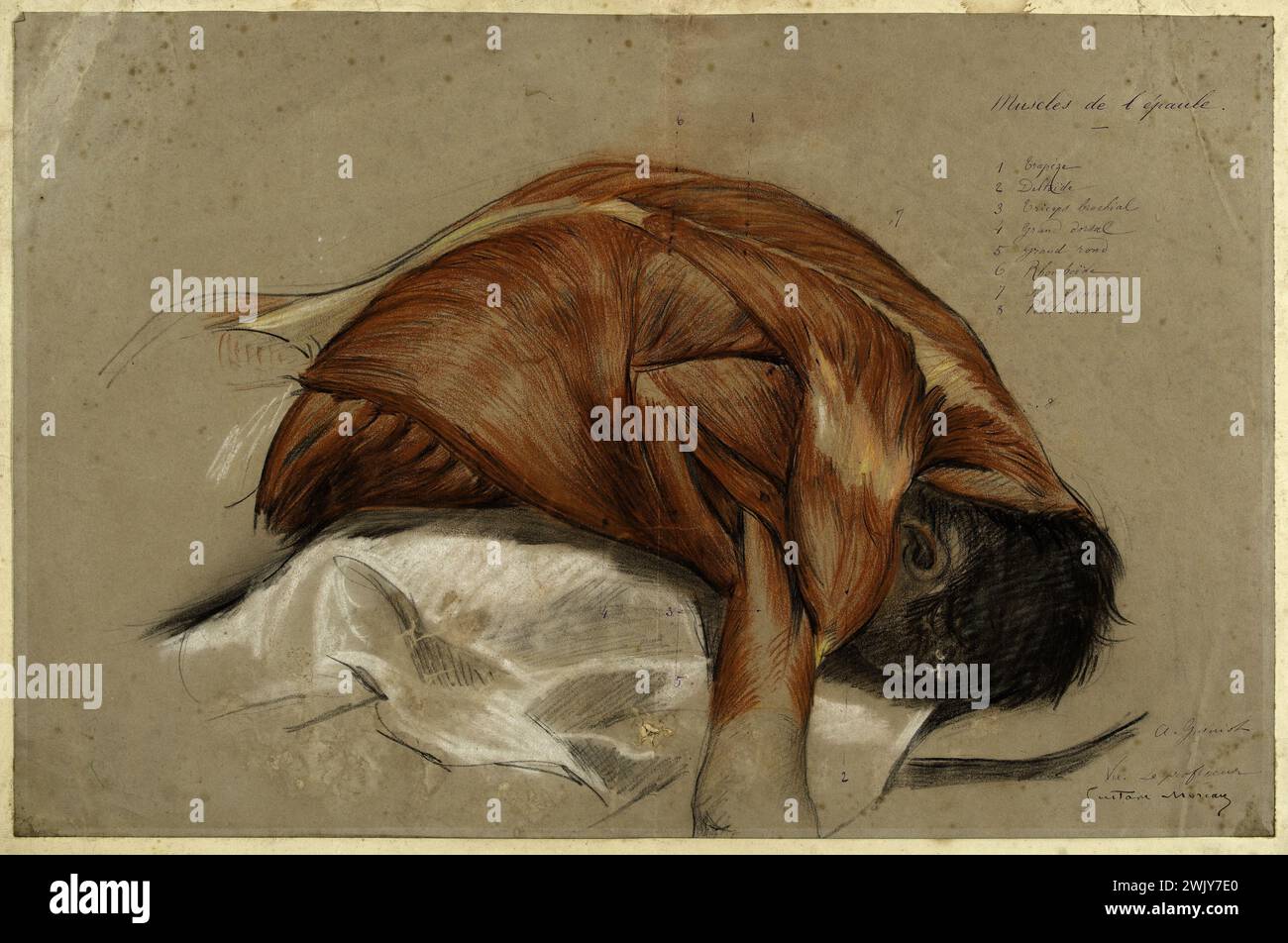 Arthur-Joseph Guéniot (1866-1951). Anatomical study. Bust of flayed man ...