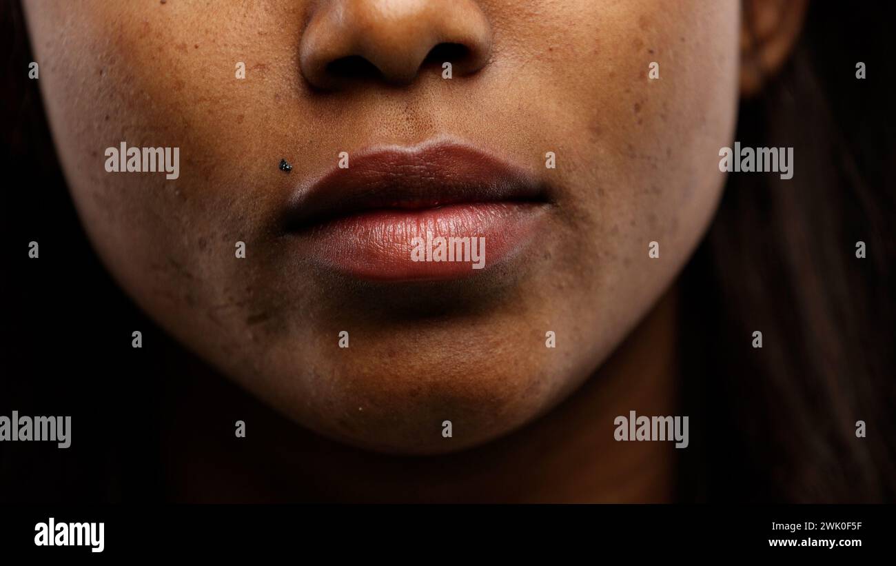 Woman face red swollen hi-res stock photography and images - Alamy