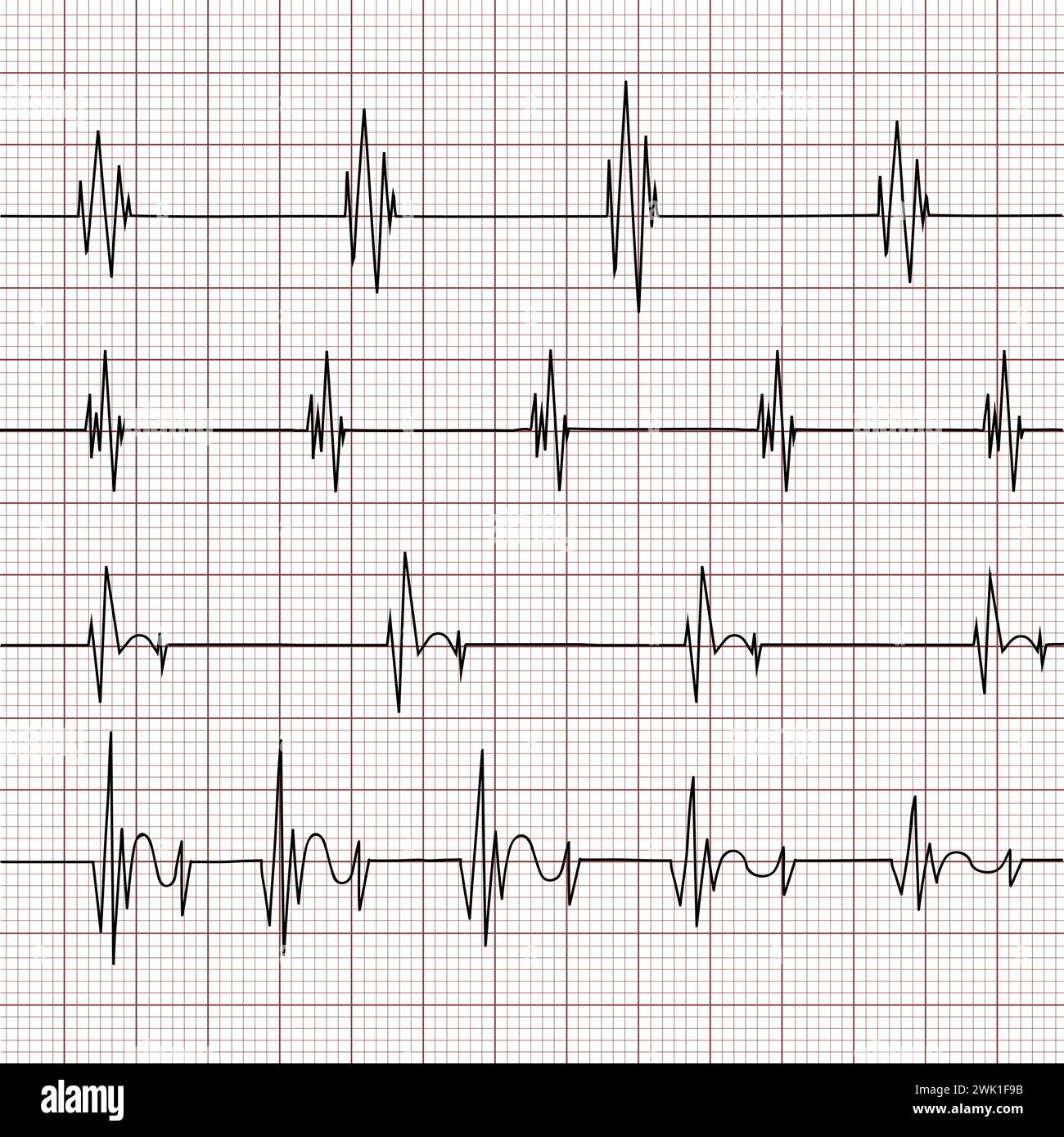 Multiple EKG (Electrocardiogram) graphs on a grid background. Various ...