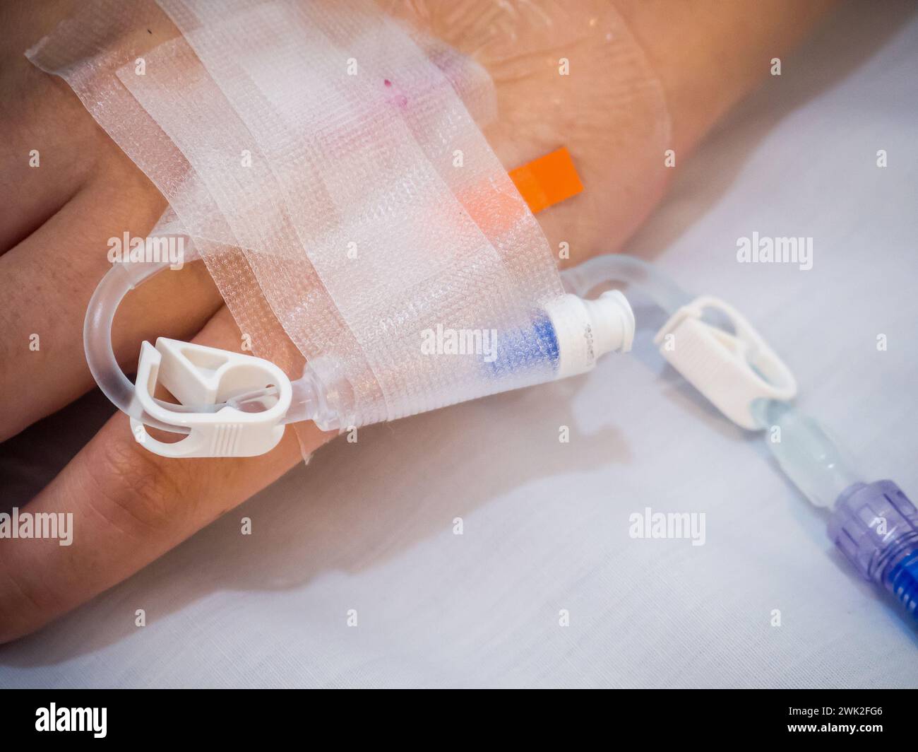 Asian woman patient hand on IV drip with saline solution, fluid ...