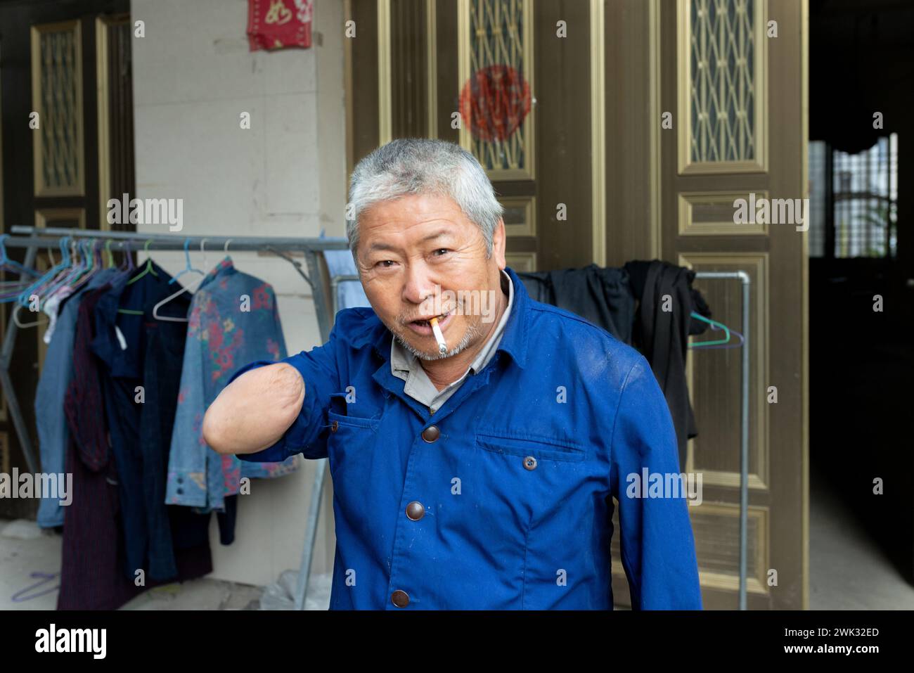 Amputated arm hi-res stock photography and images - Alamy