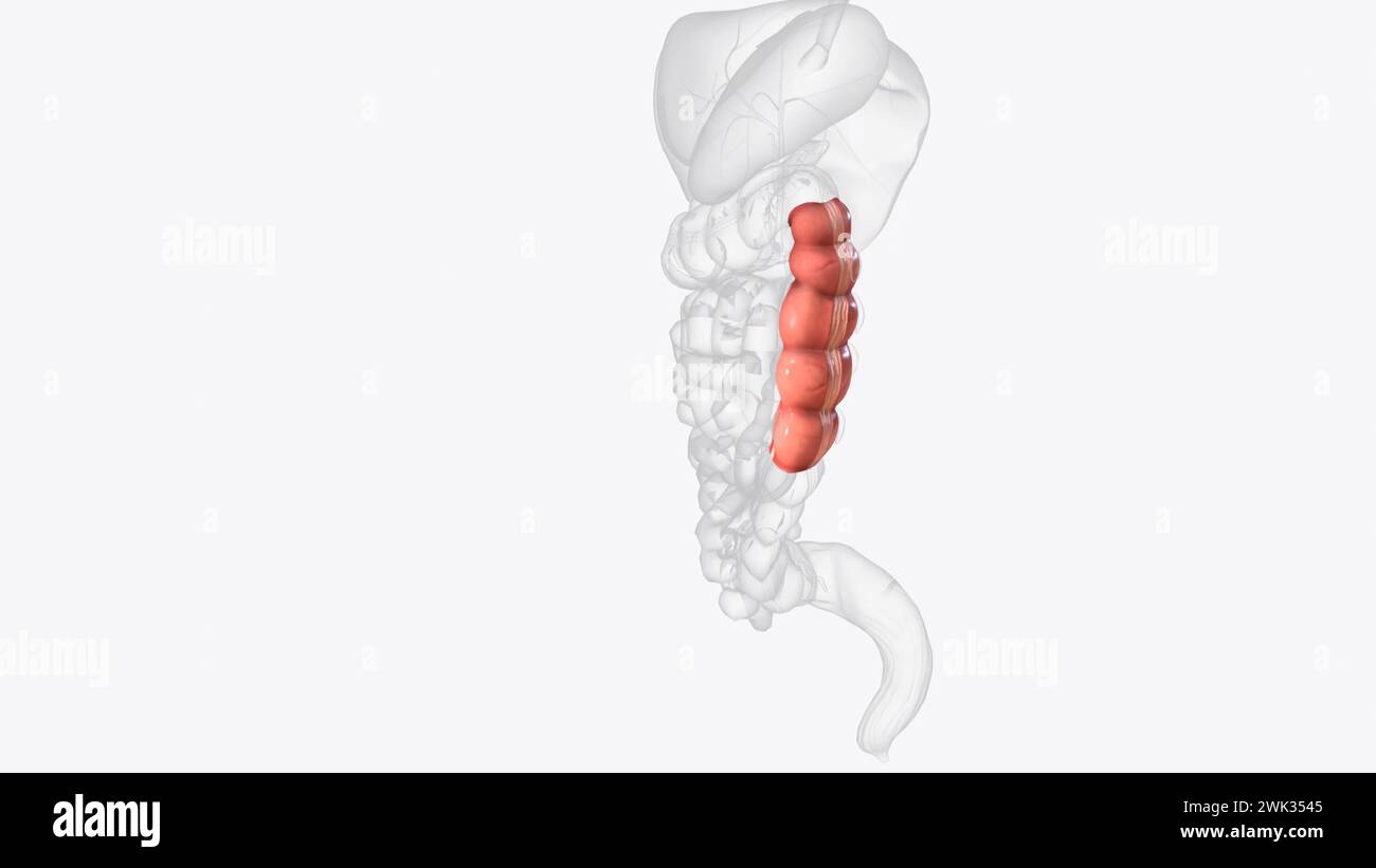 Large intestine endoscopy hi-res stock photography and images - Alamy