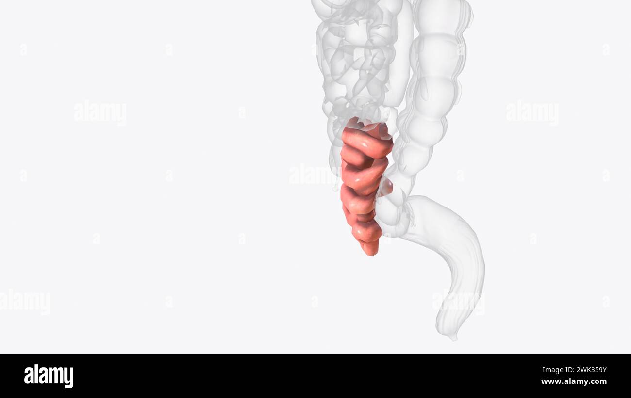 Ileum endoscopy hi-res stock photography and images - Alamy