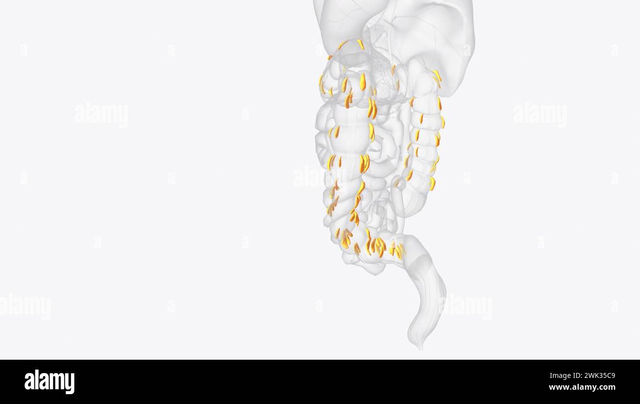 Peritoneal inflammation hi-res stock photography and images - Alamy