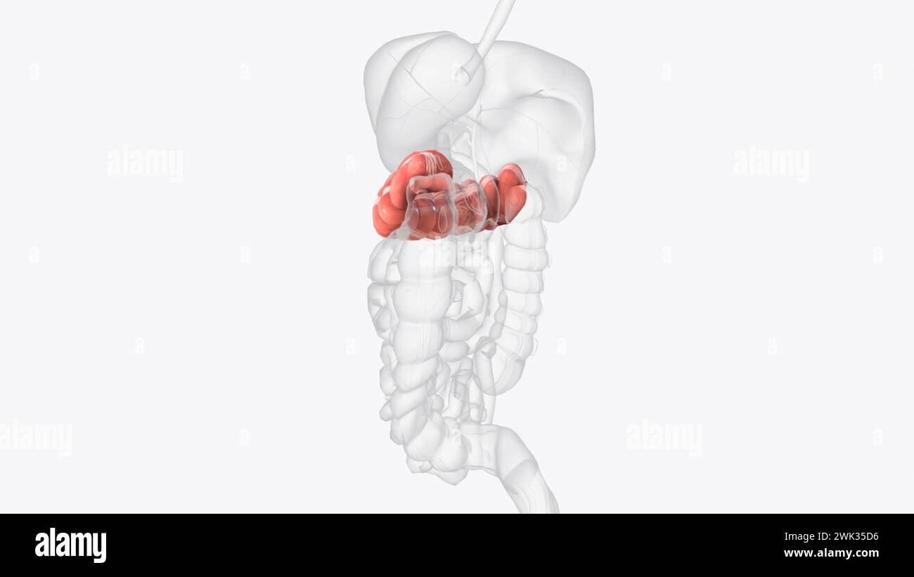 Large intestine endoscopy hi-res stock photography and images - Alamy