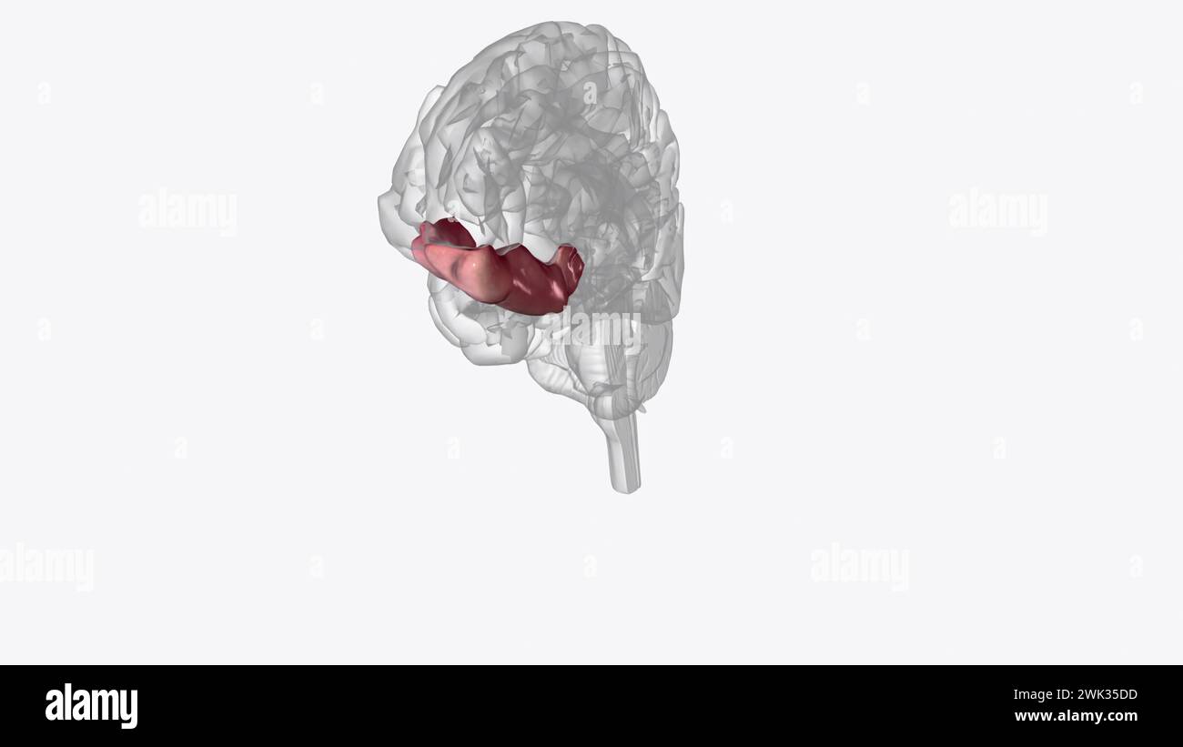 The right inferior frontal gyrus (rIFG) is considered a key node for ...