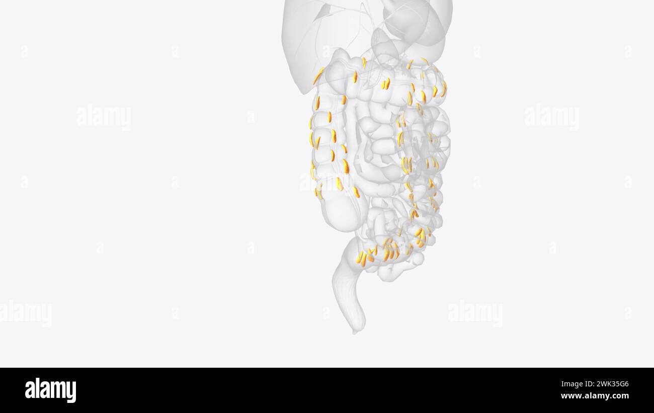 Peritoneal inflammation hi-res stock photography and images - Alamy