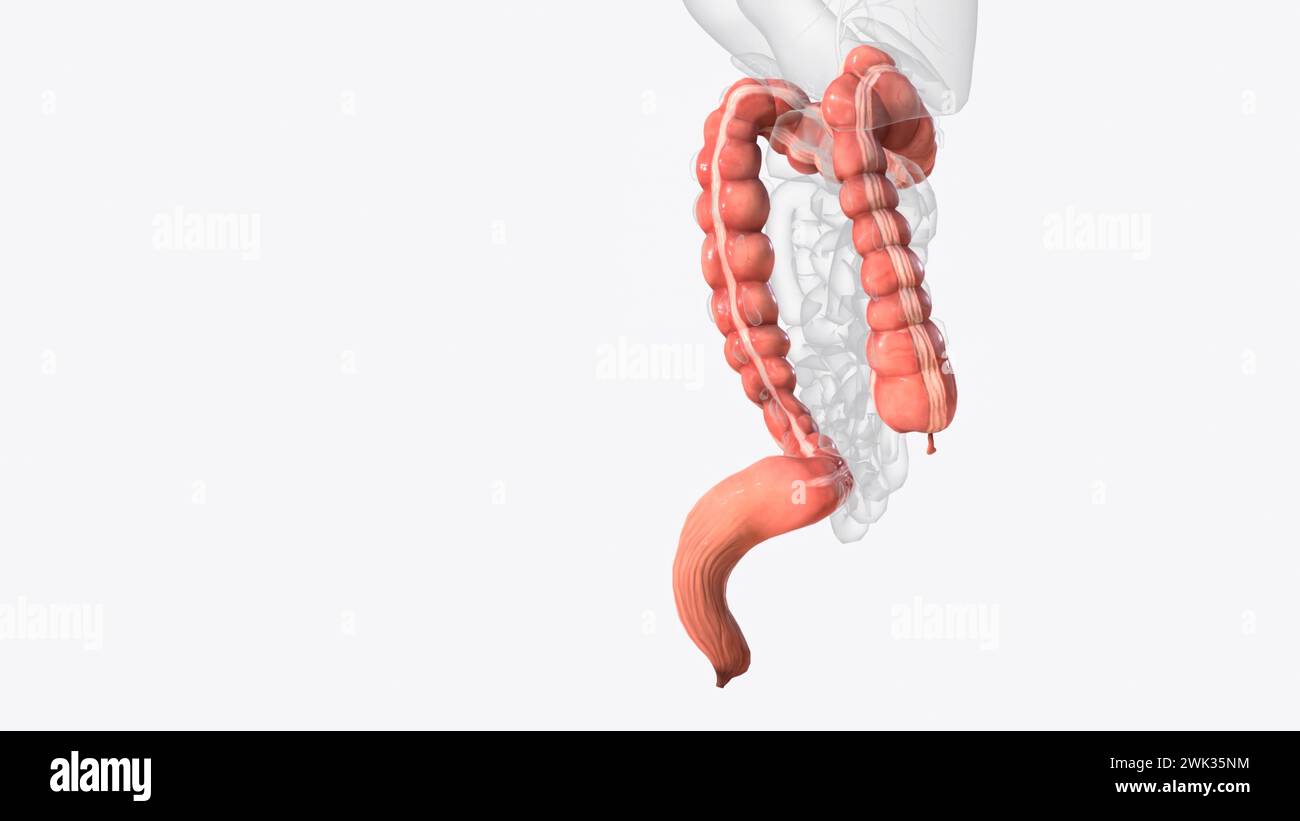 Large intestine endoscopy hi-res stock photography and images - Alamy