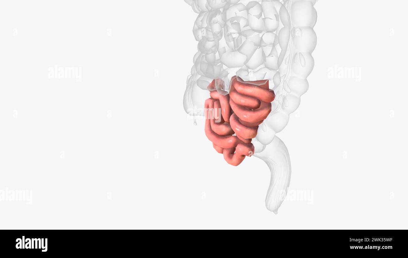 Ileum endoscopy hi-res stock photography and images - Alamy