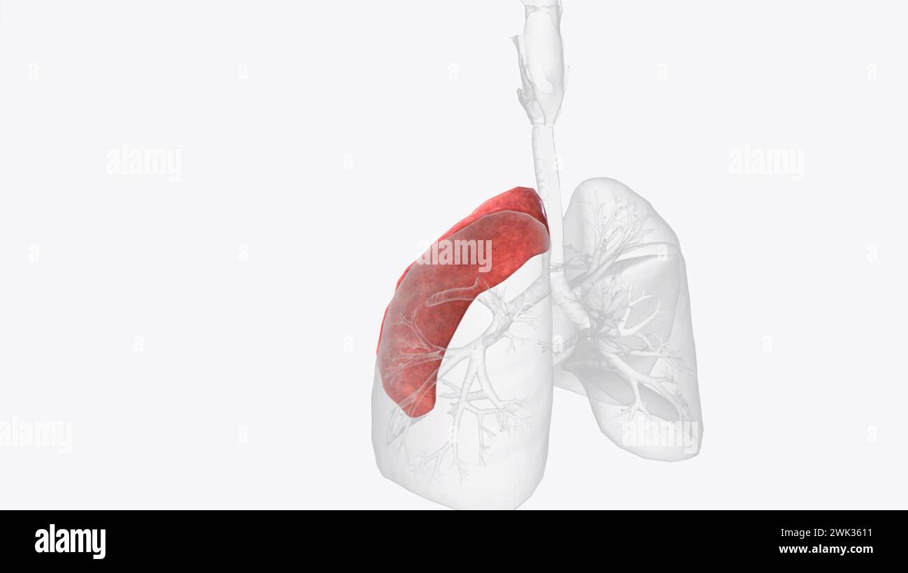 The superior lobe of the left lung is divided into five ...