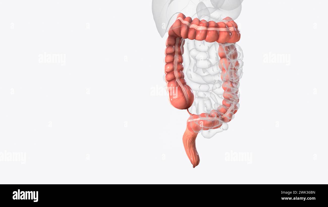 Large intestine endoscopy hi-res stock photography and images - Alamy