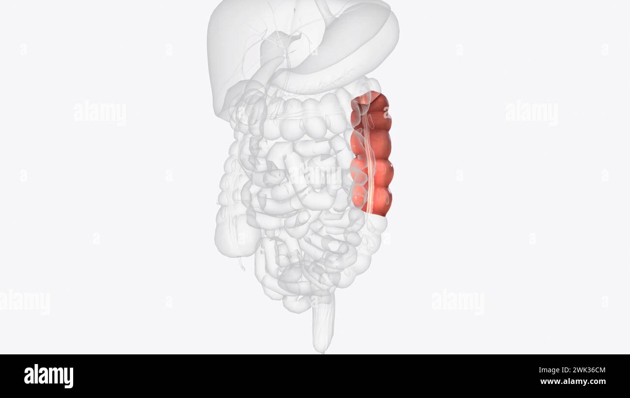 Large intestine endoscopy hi-res stock photography and images - Alamy