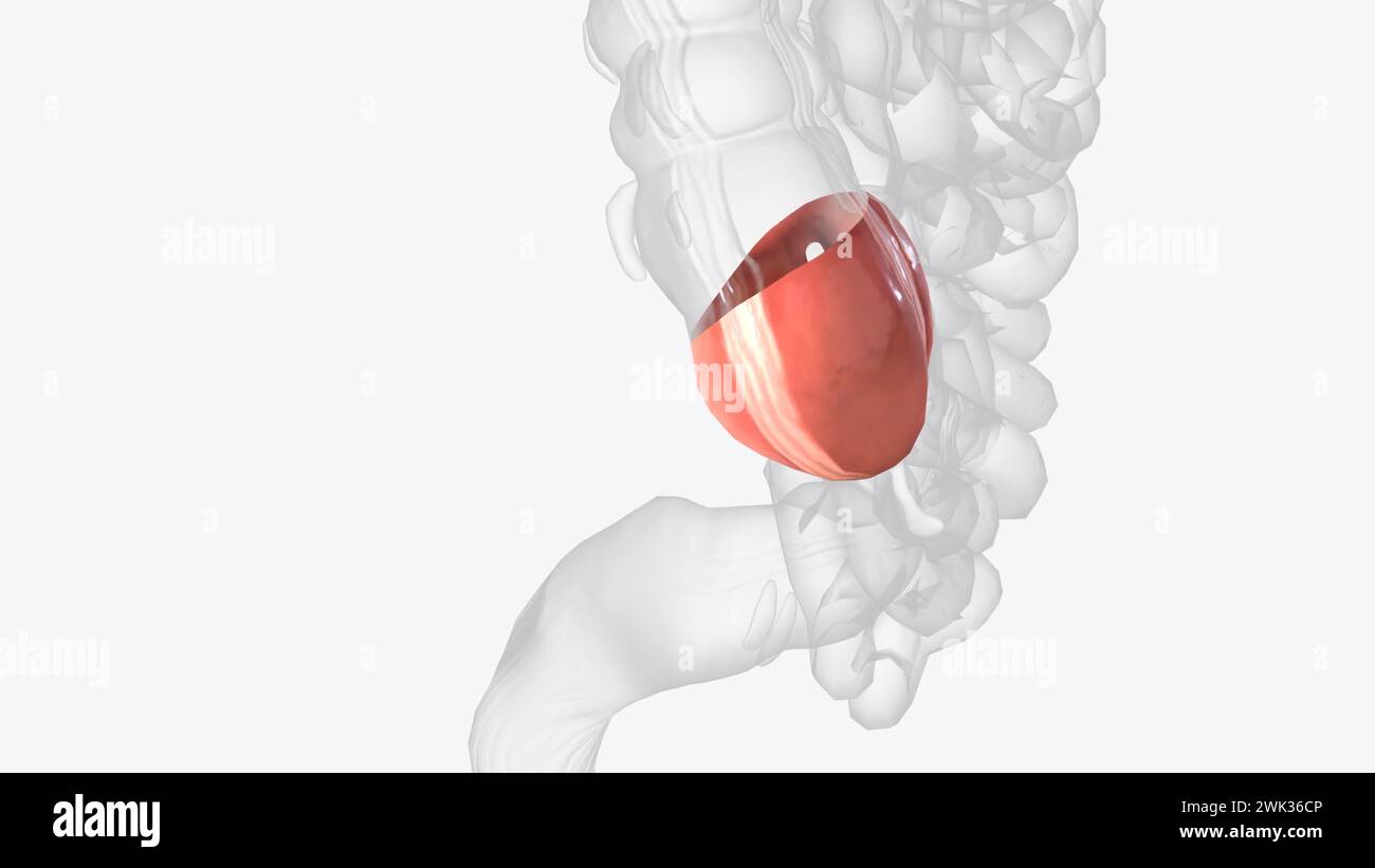 Endoscope large intestine hi-res stock photography and images - Alamy