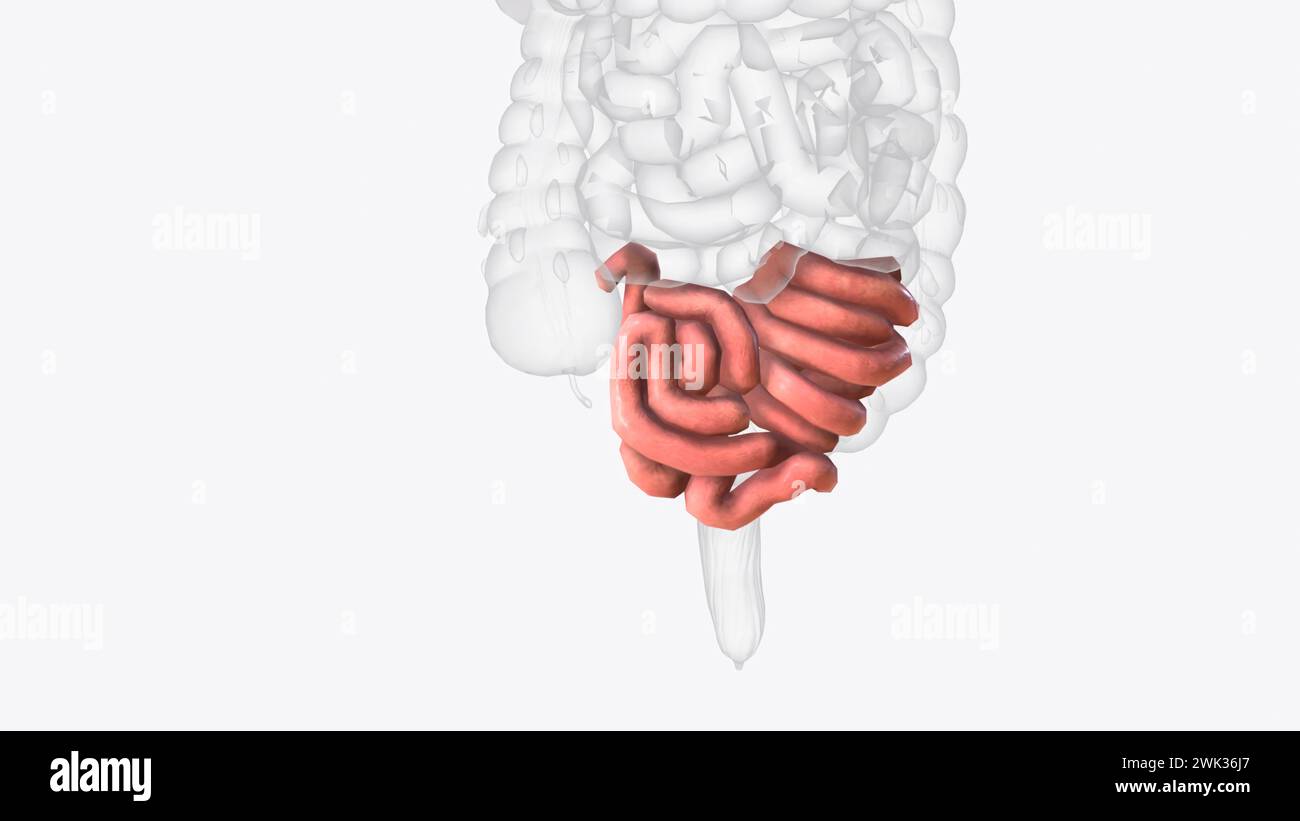 Ileum endoscopy hi-res stock photography and images - Alamy