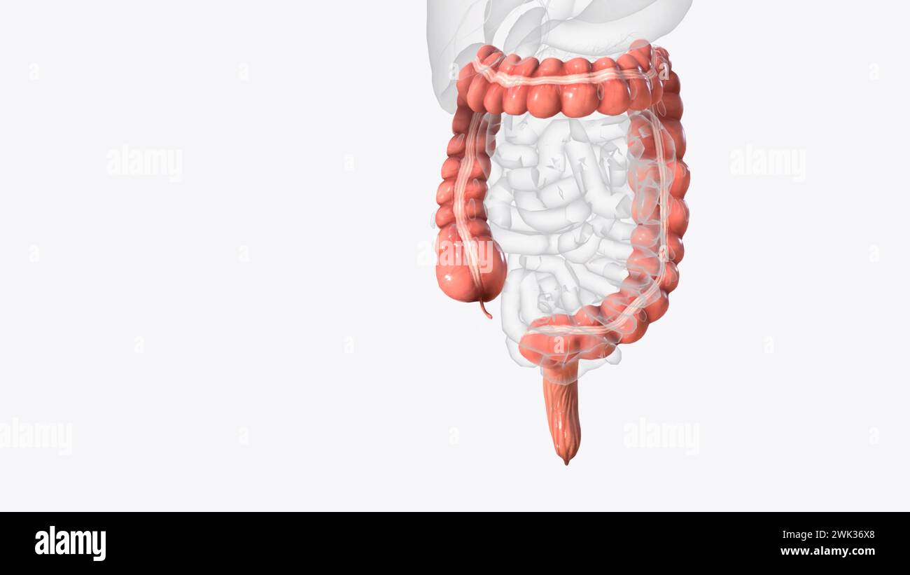 Large intestine endoscopy hi-res stock photography and images - Alamy