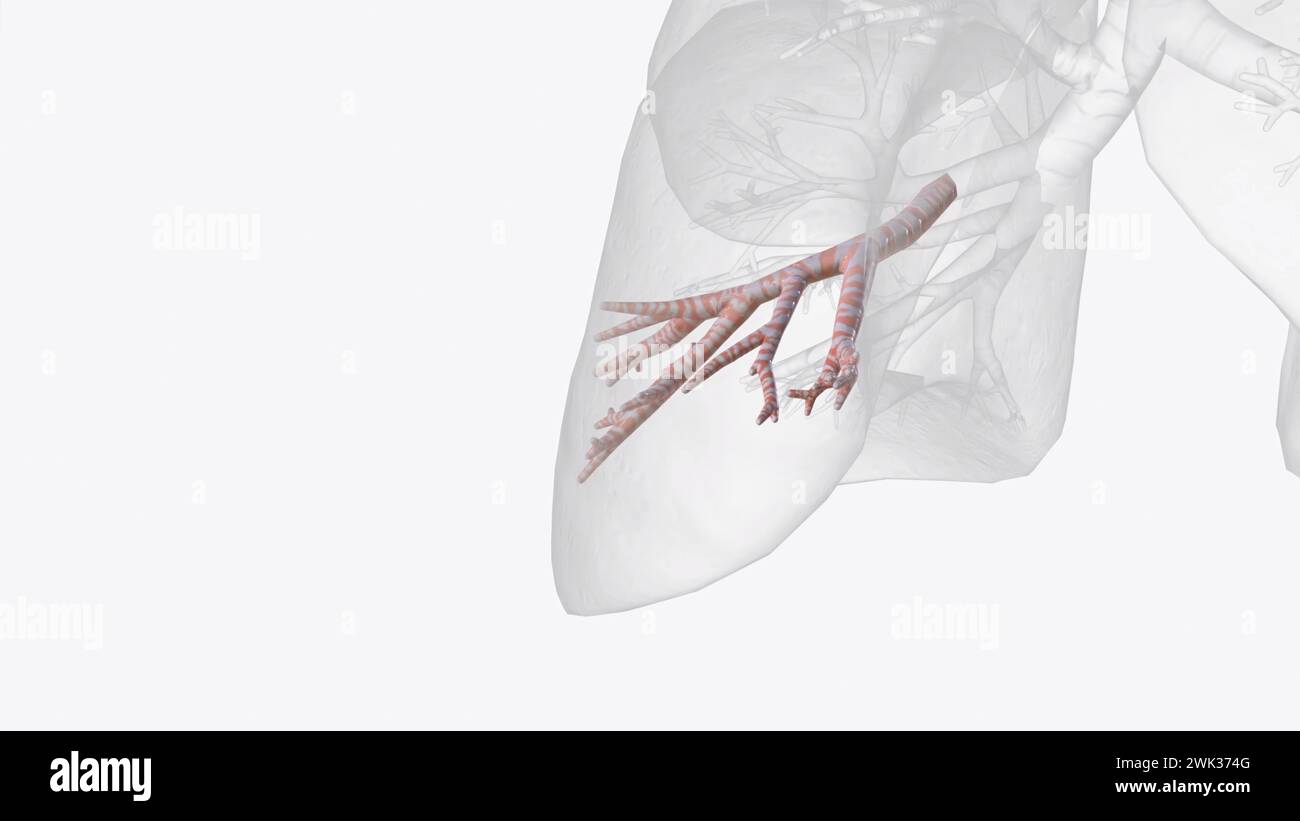 Tertiary bronchi hi-res stock photography and images - Alamy