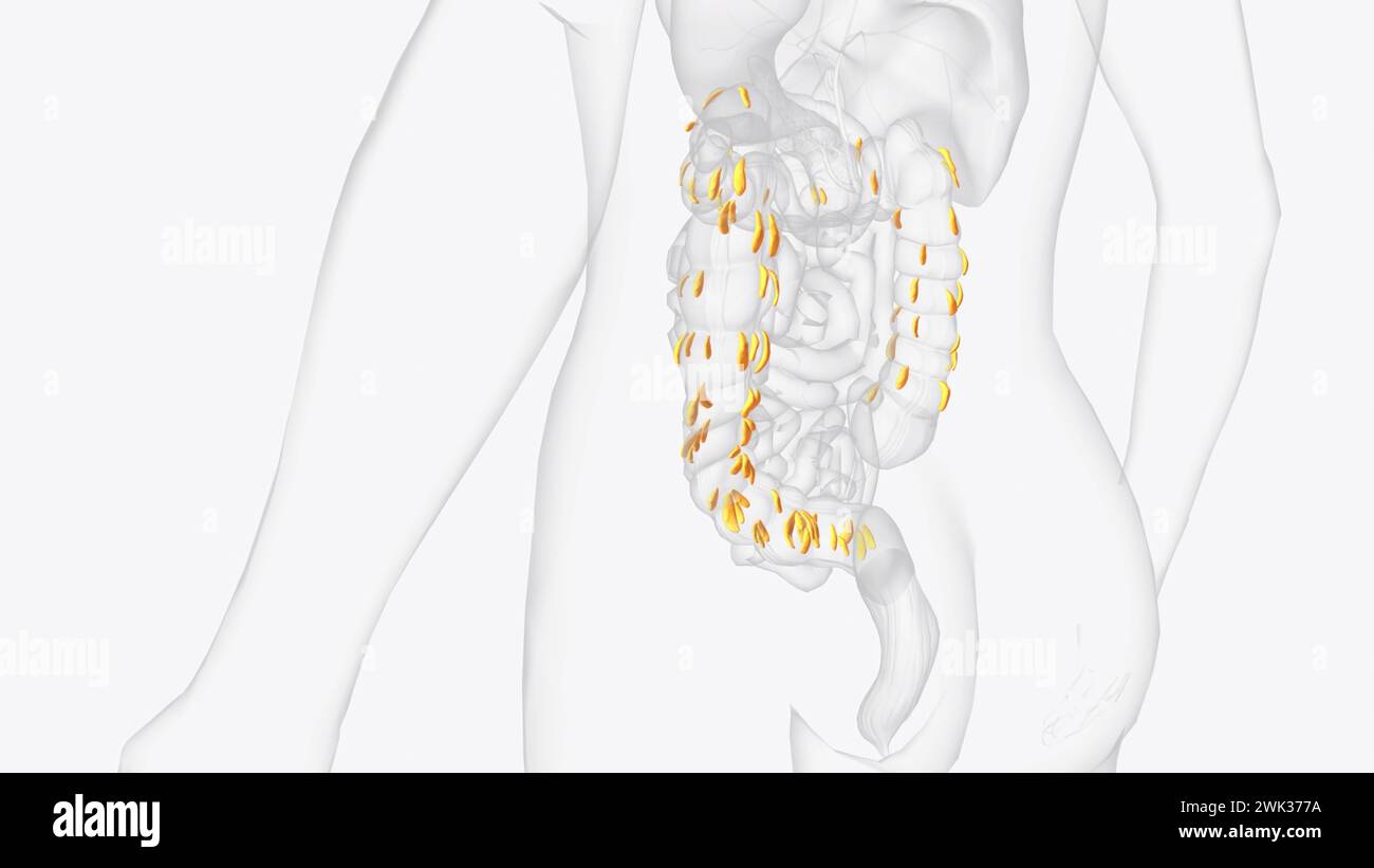 Peritoneal inflammation hi-res stock photography and images - Alamy
