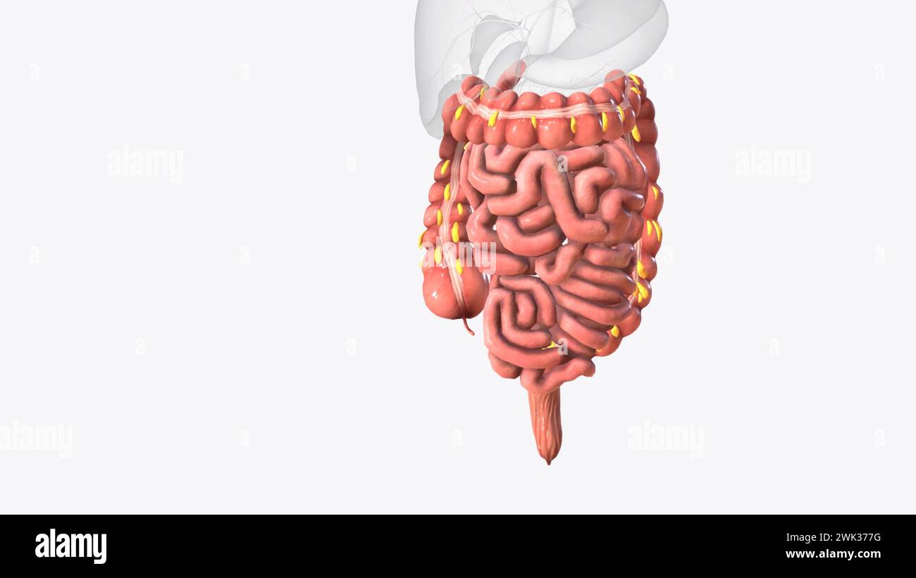 Colonoscopy normal large intestine hi-res stock photography and images ...