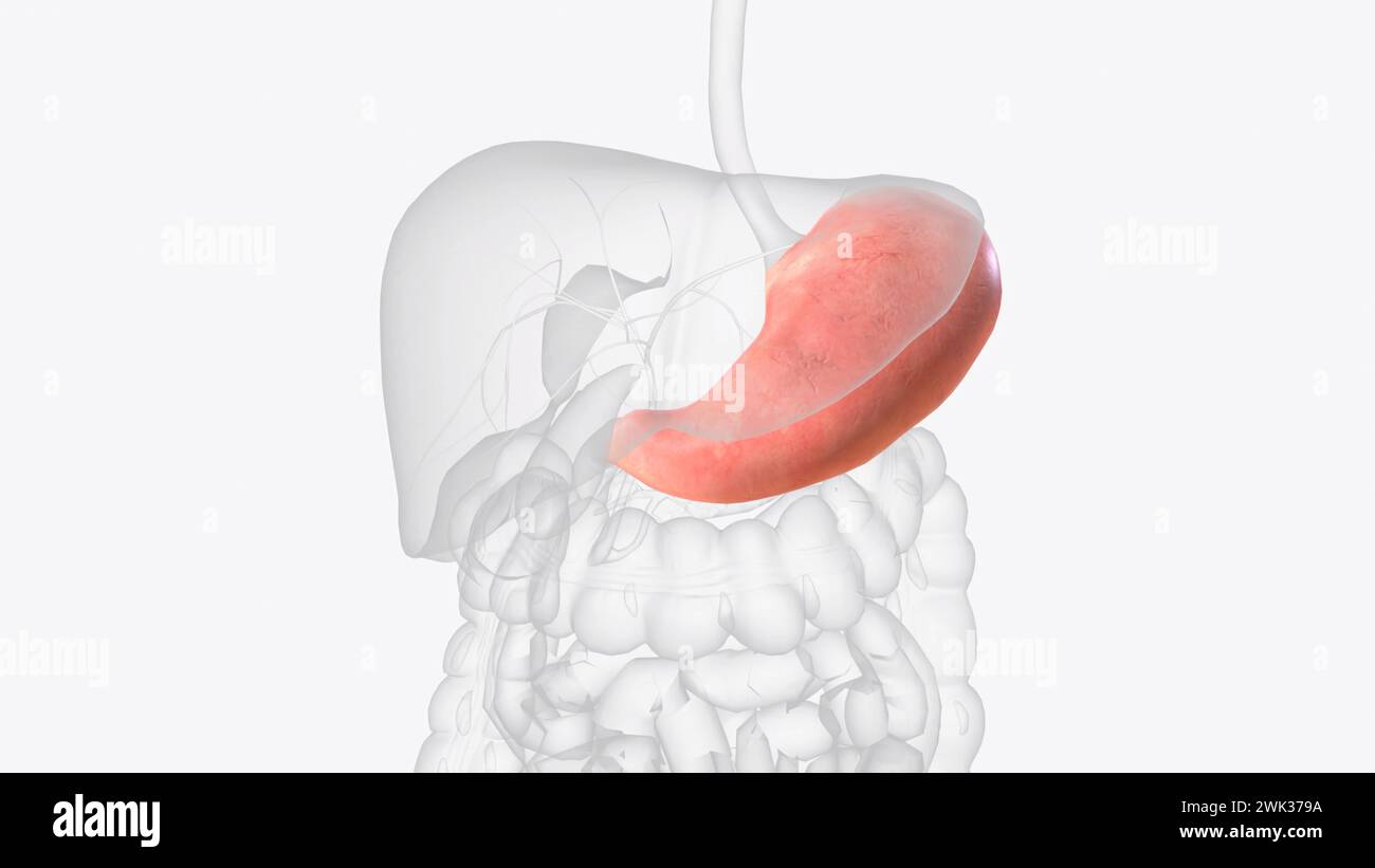 Stomach ulcer endoscope hi-res stock photography and images - Alamy