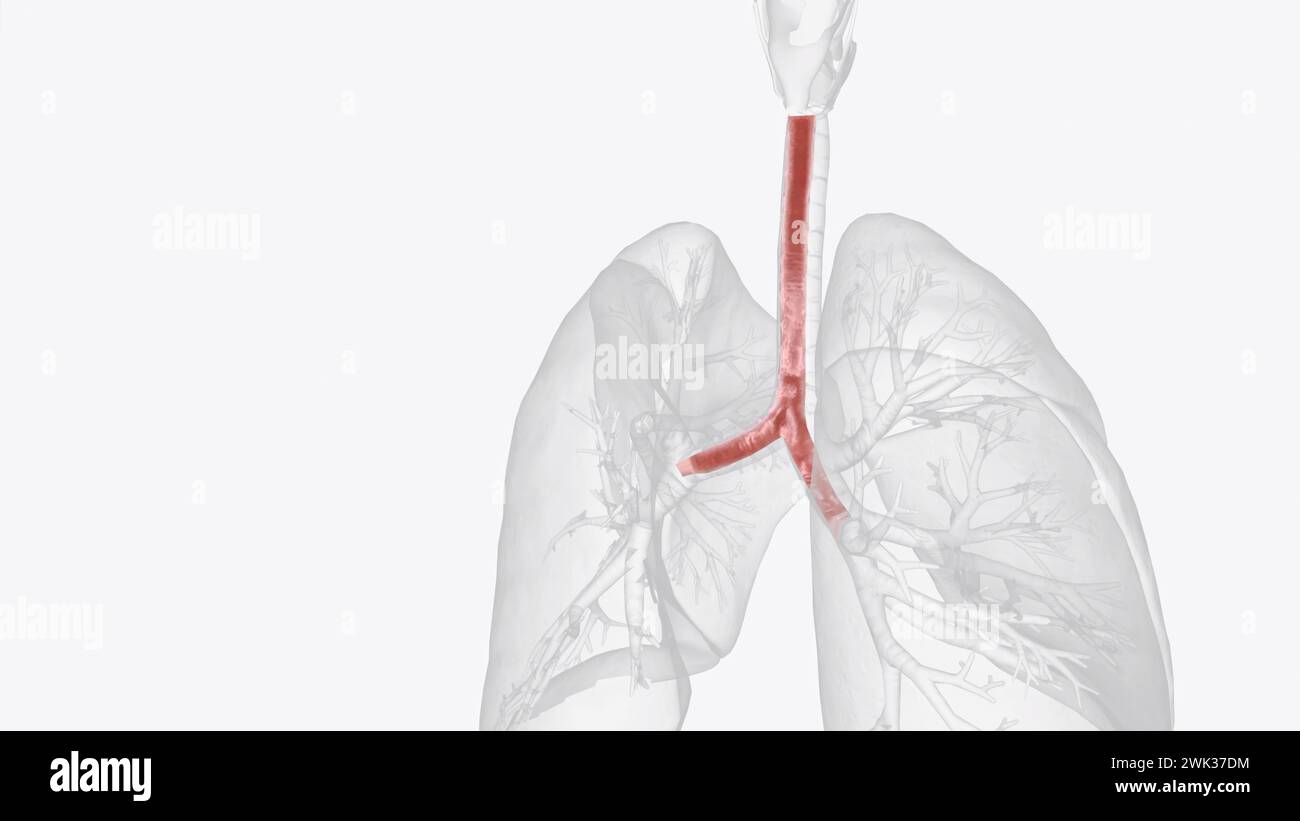 Trachealis hi-res stock photography and images - Alamy