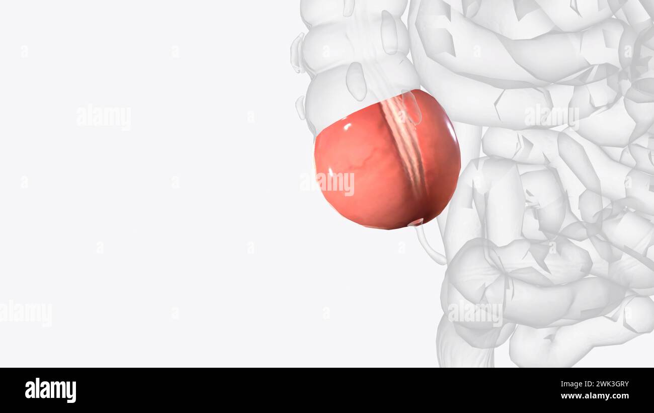 Cecum endoscopy hi-res stock photography and images - Alamy