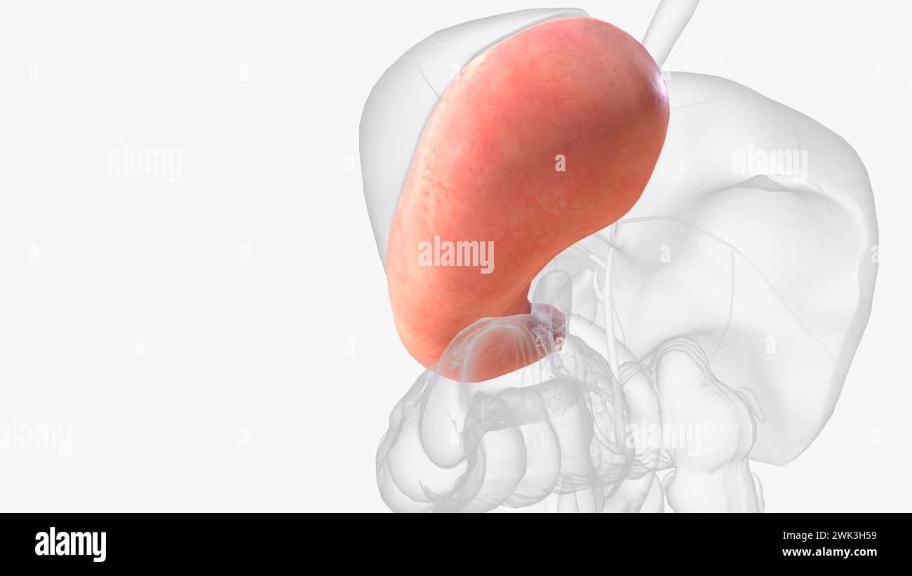 Stomach ulcer endoscope hi-res stock photography and images - Alamy