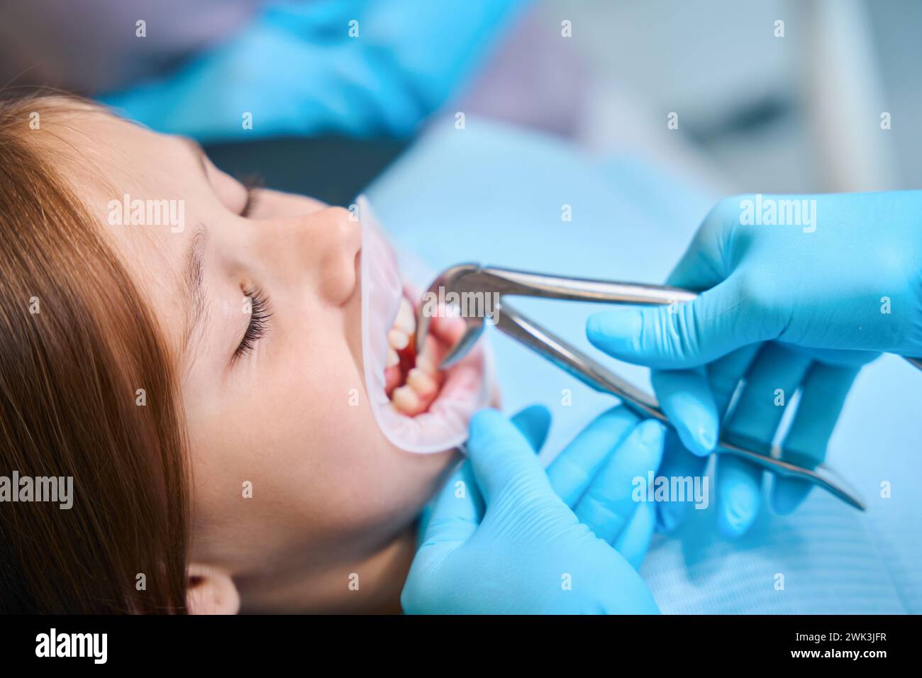 Child undergoing tooth extraction at the dentist Stock Photo - Alamy