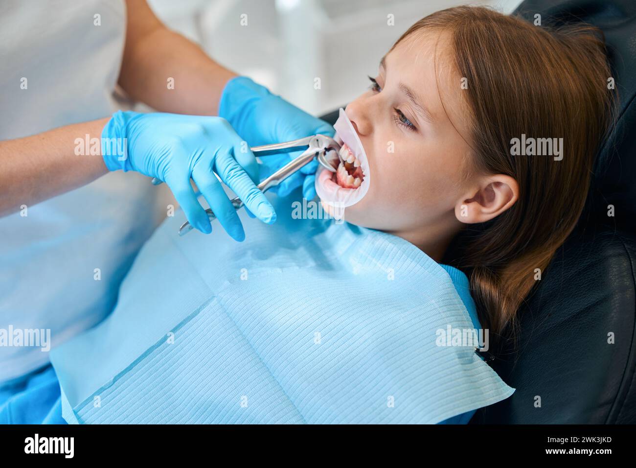 Procedure for removing a child tooth Stock Photo - Alamy