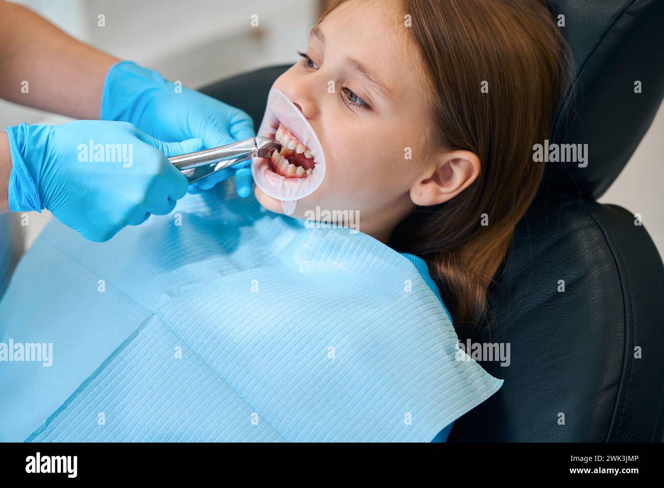 Procedure for removing a tooth for a child Stock Photo - Alamy