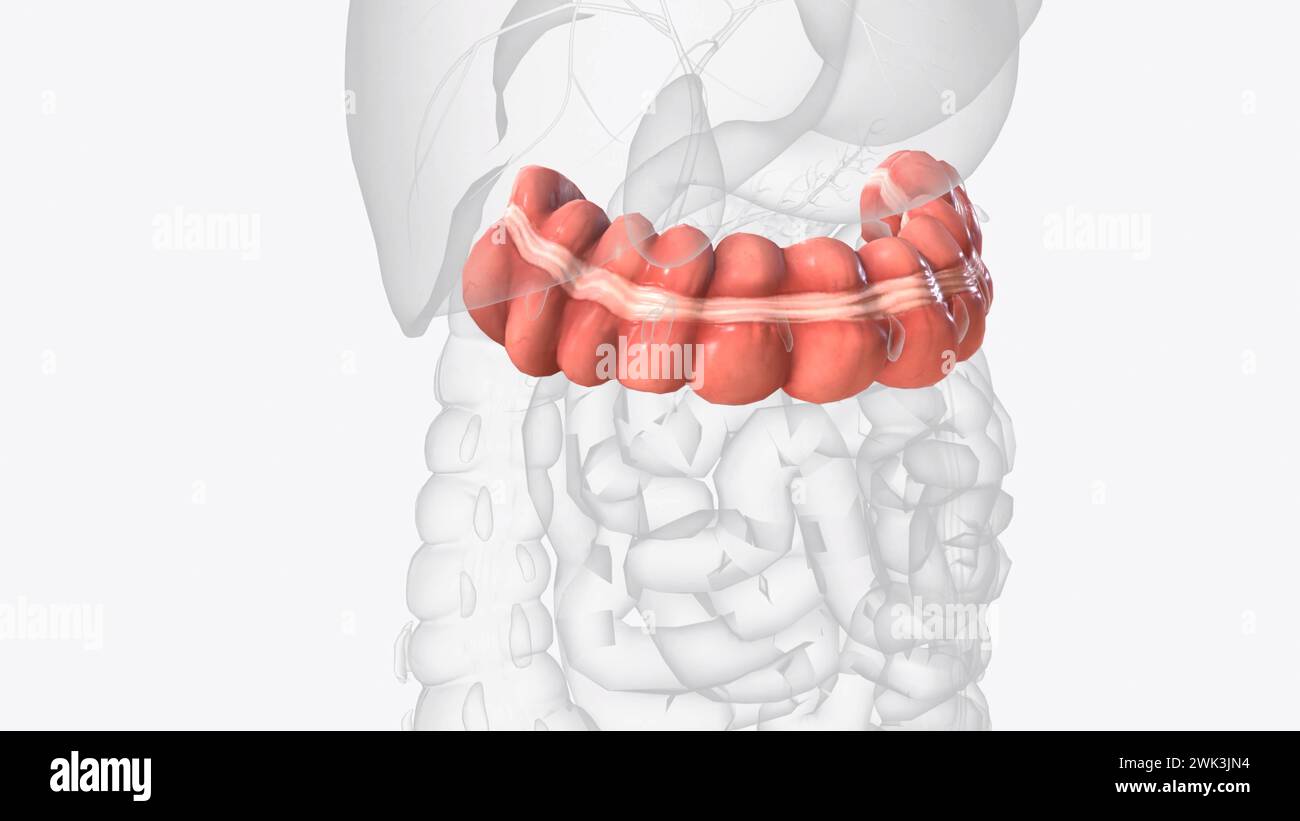 The transverse colon is the lengthy, upper part of the large intestine ...