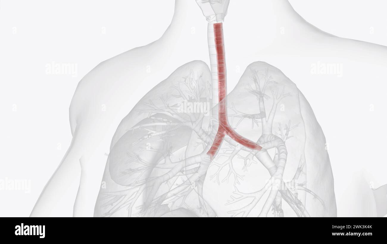 Trachealis hi-res stock photography and images - Alamy