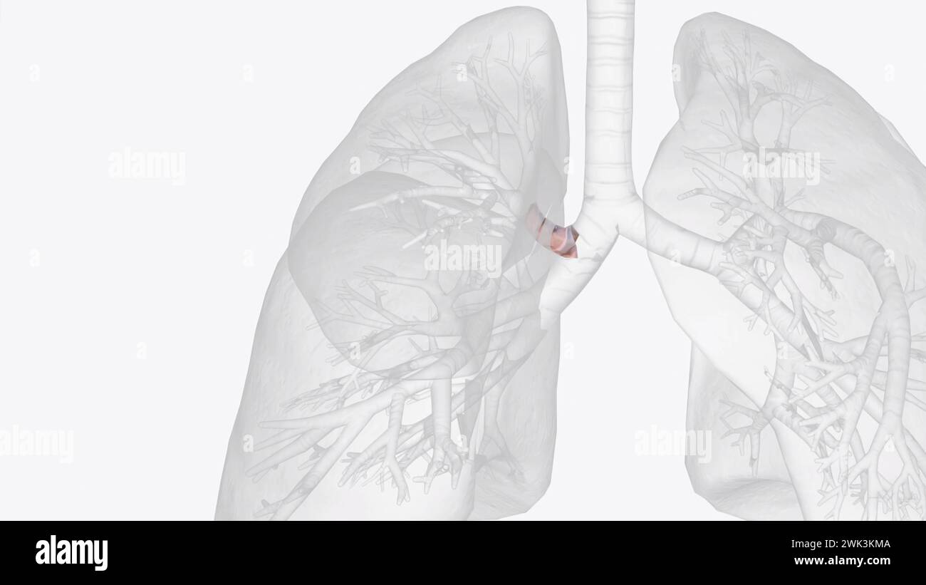 Lobar pneumonia hi-res stock photography and images - Alamy