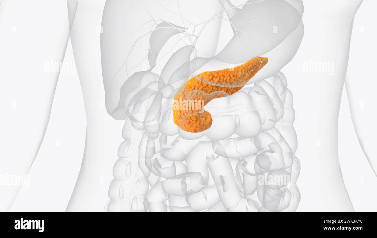Endoscopy barrett esophagus hi-res stock photography and images - Alamy