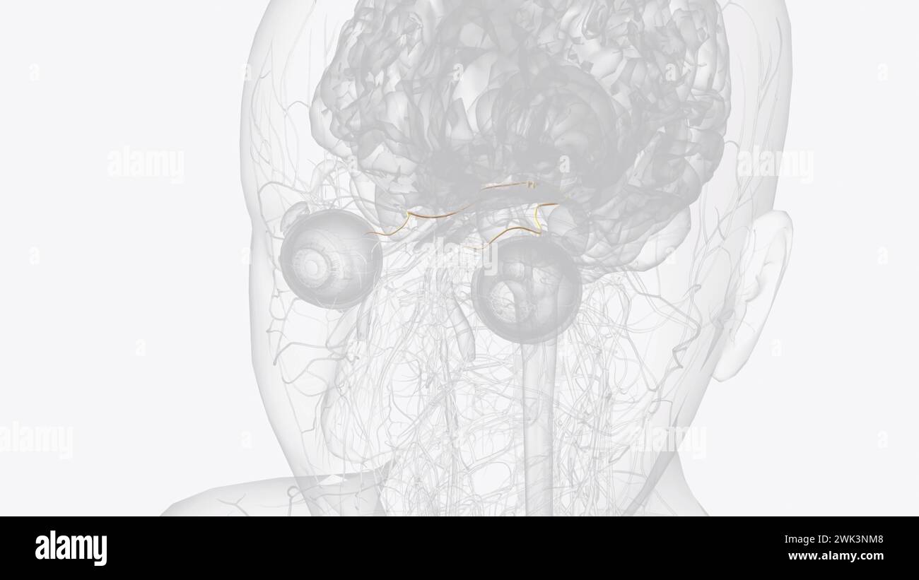 The trochlear nerve is the fourth cranial nerve (CN IV) and one of the ...