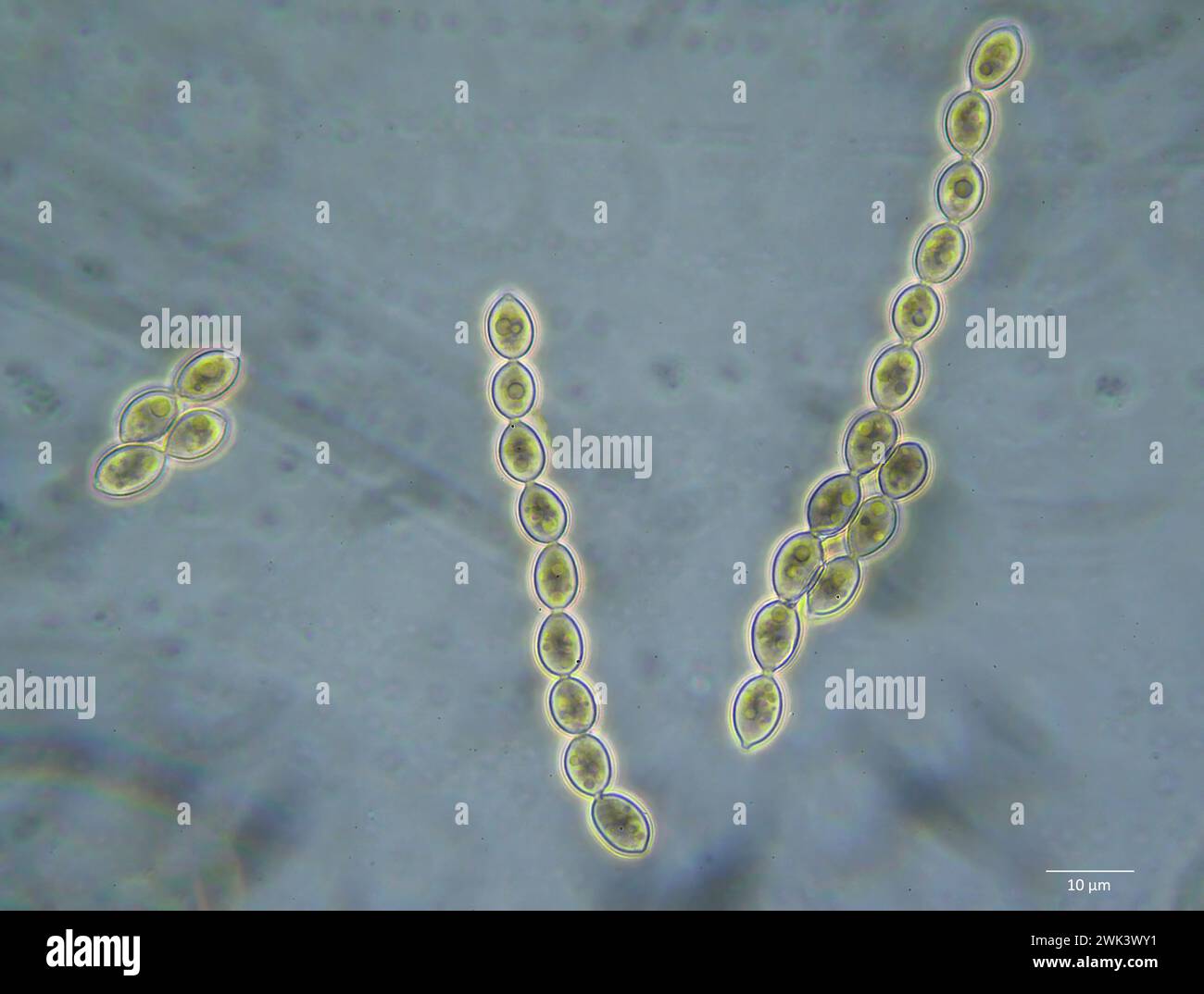 Asexual chlamydiospores hi-res stock photography and images - Alamy