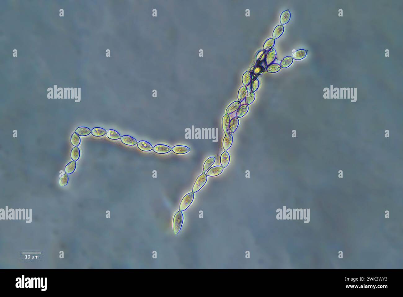 Chain of asexual, non-motile spores from an anamorph (asexual ...