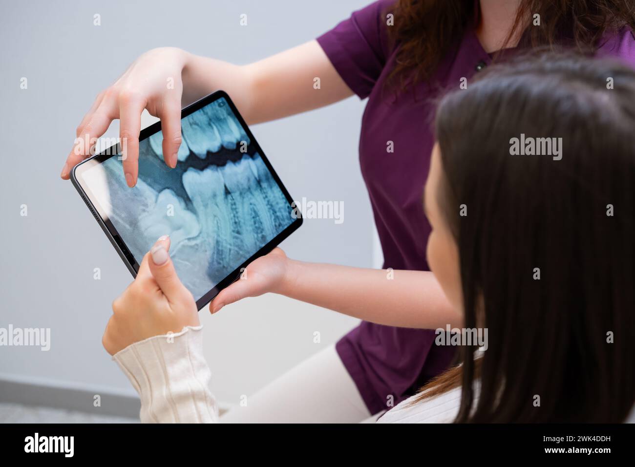 Dentist discussing tooth extraction procedure with patient showing x ...