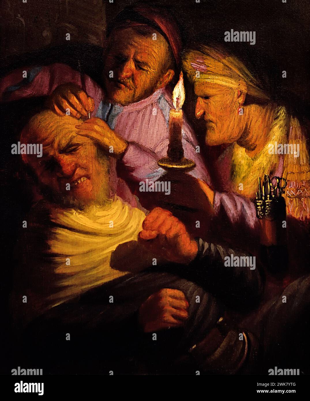 Stone operation ( Allegory of Touch - The Quack Doctor )) 1624-1625 by ...