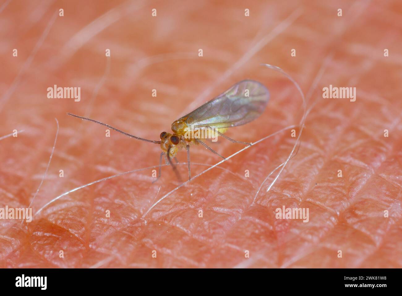 Small insect booklice, barklice or barkflies on human skin Stock Photo ...