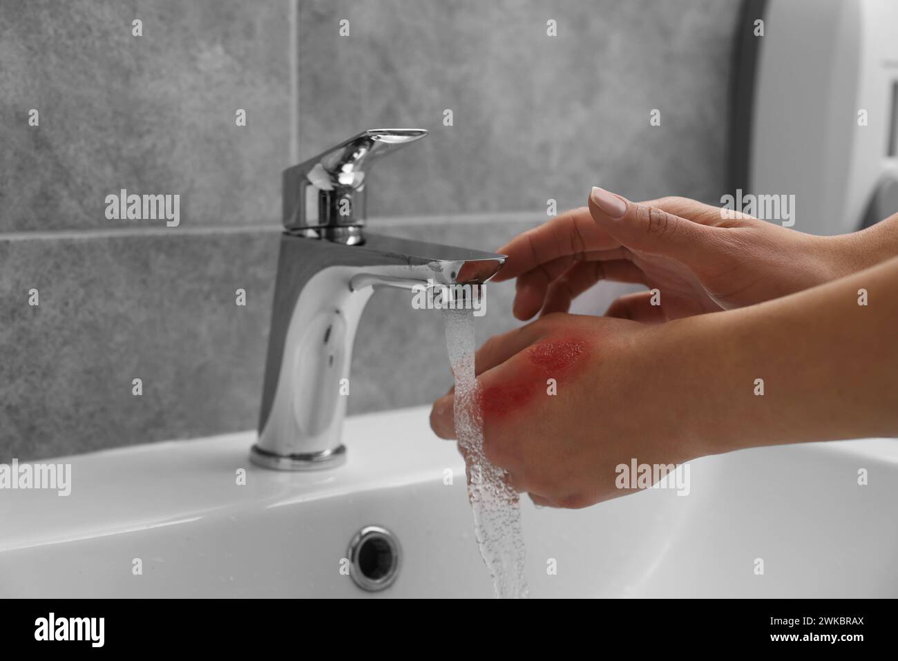 Burn skin cold water hi-res stock photography and images - Alamy