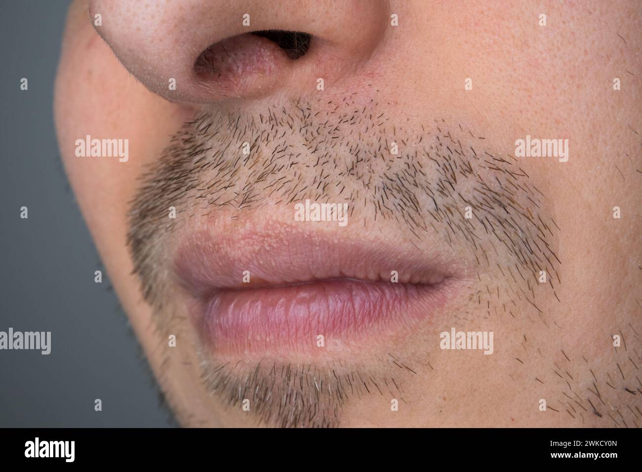 Caucasian male with uneven stubble, unshaven, close up shot ...