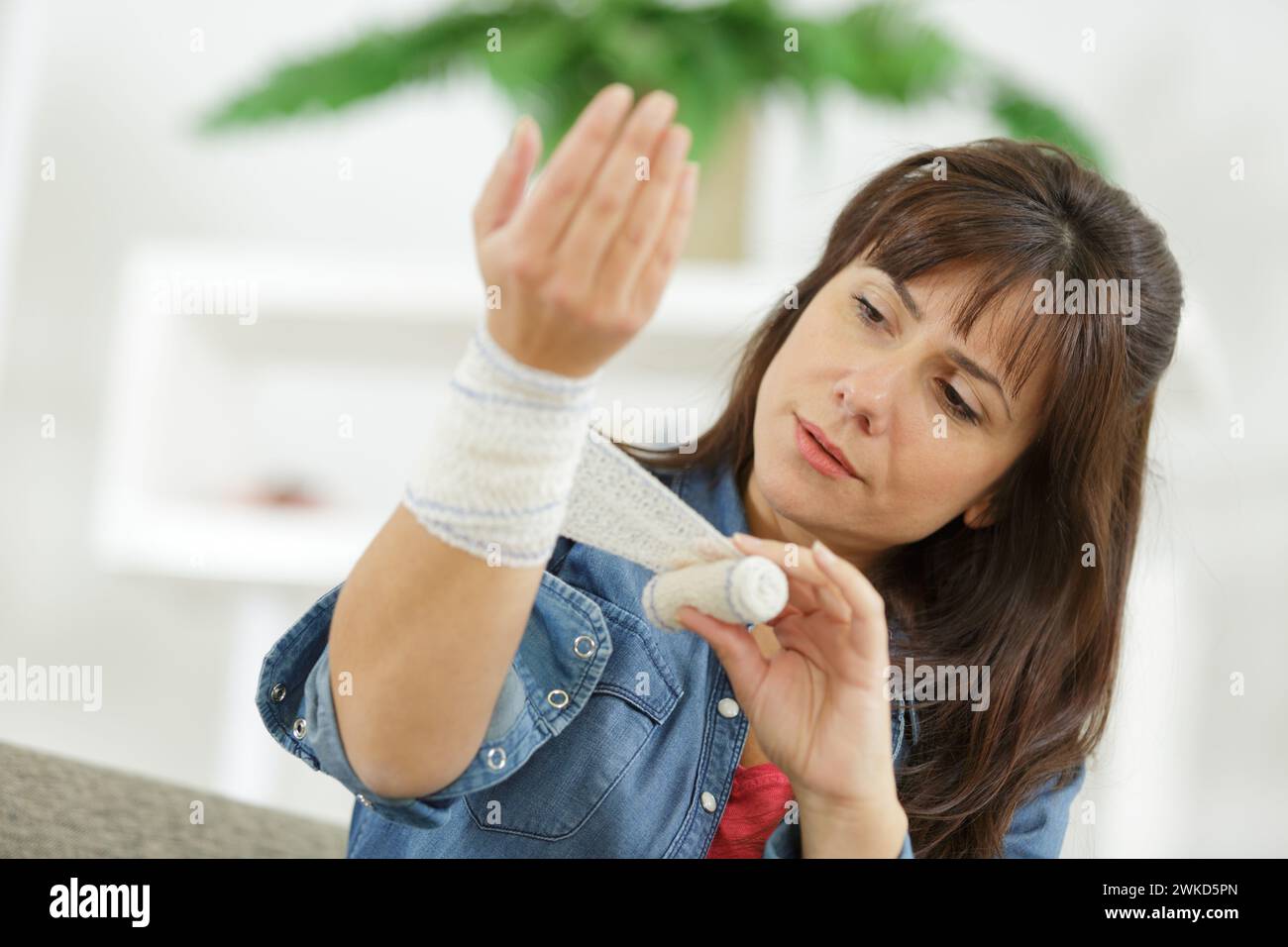Bruised arm hi-res stock photography and images - Alamy