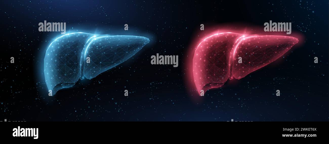 Normal and red liver. Fatty liver, Bile detox, Nash disease Stock ...