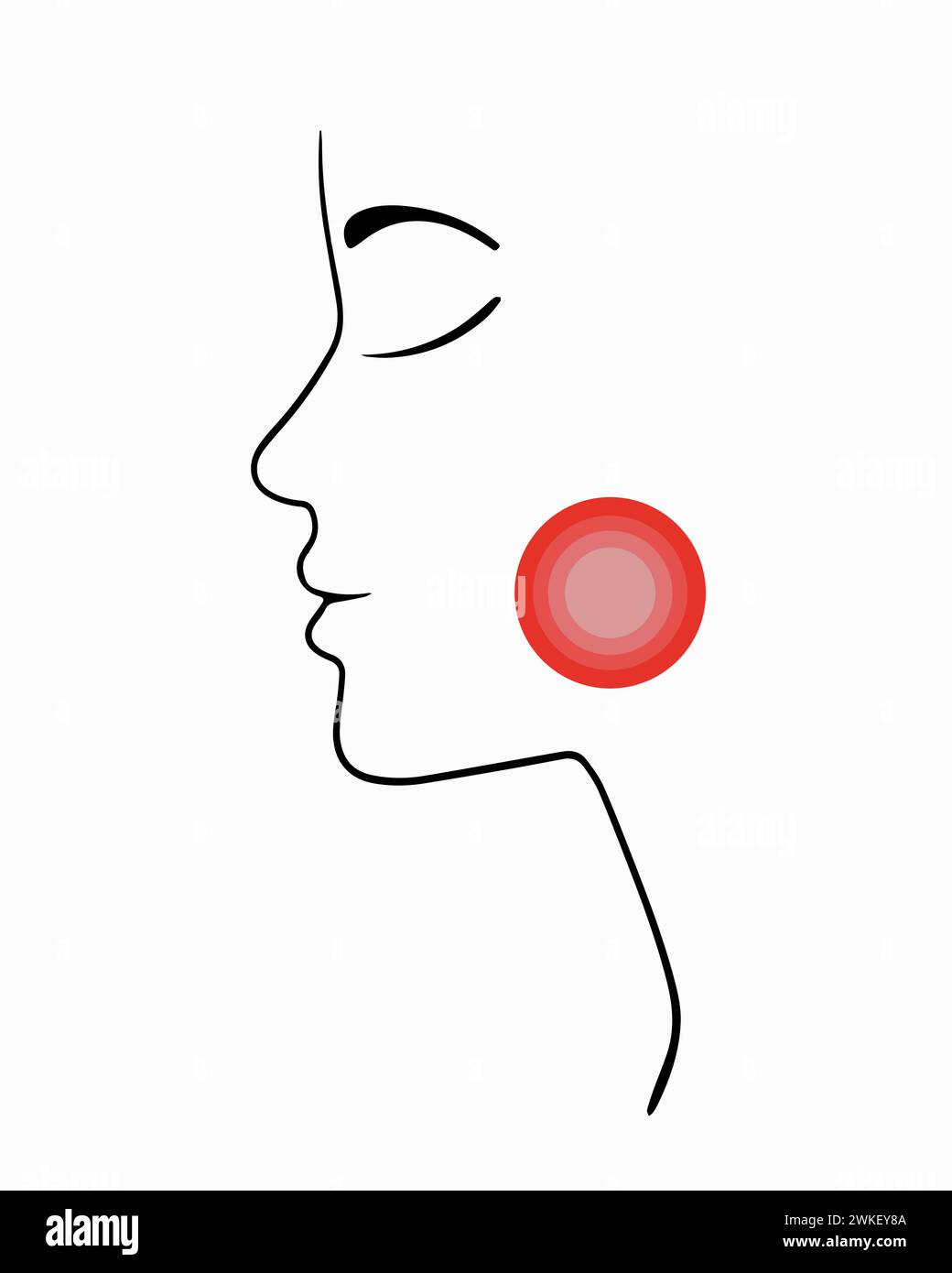 Vector isolated illustration of sore throat . Pain in sore throat Stock ...